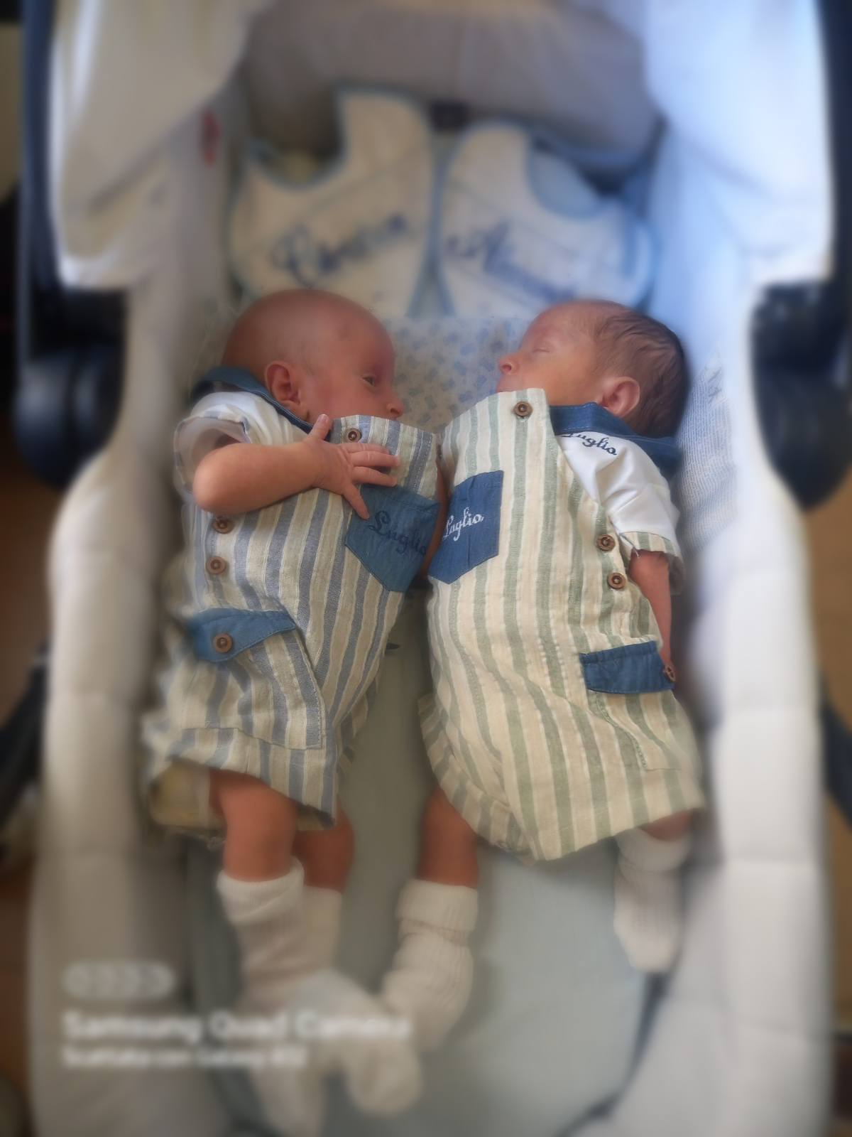 Operati in utero alla 26° settimana di gestazione due gemellini affetti ...